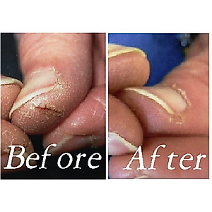 HerillaFingerHydration#