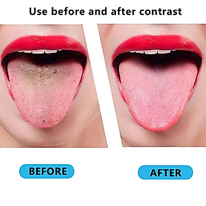 Tongue Scraper Stainless Steel Tongue Cleaners Reduce Bad Breath Metal Tough Scrapers Reduce Bad Breath and Fresh Breath for Kids And Adults