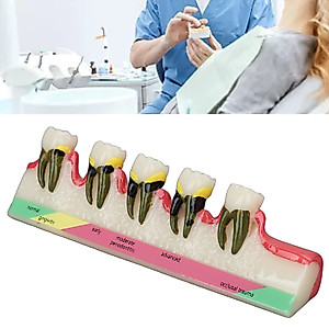 Natudeco Tooth Model Oral Care Model Denture Kit Strong Durable And Convenient. Teachers Use Order Remarks Product Box Plus Buffer Cotton Delivery