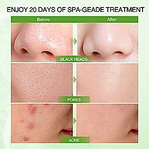 Clay Mask Avocado Dead sea Mud Stick Mask Natural Organic Green Tea Mud Mask Deep Cleansing Blackhead Removal Face Mask Nourishing Hydration Facial Mask With Blackhead Remover Extractor Tools (White)