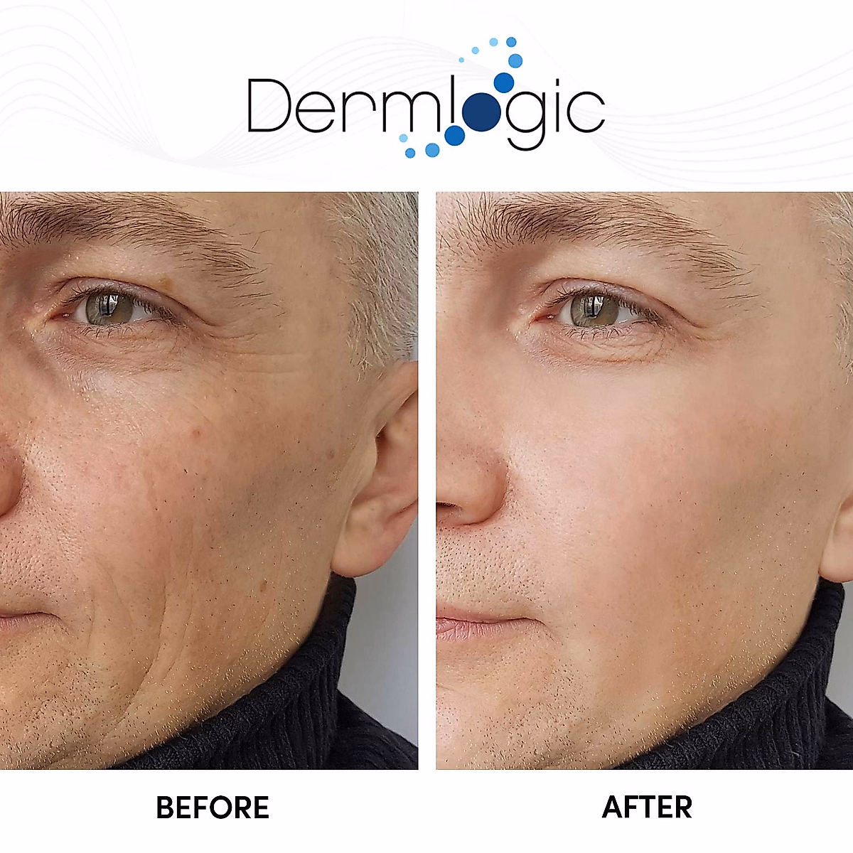 Glycolic Cream 15% - Natural Anti Aging Exfoliator to Smooth Away Fine Lines & Wrinkles & Improve a Dull Looking Complexion. Includes A.H.A & Green Tea Moisturizer for Face & Body.