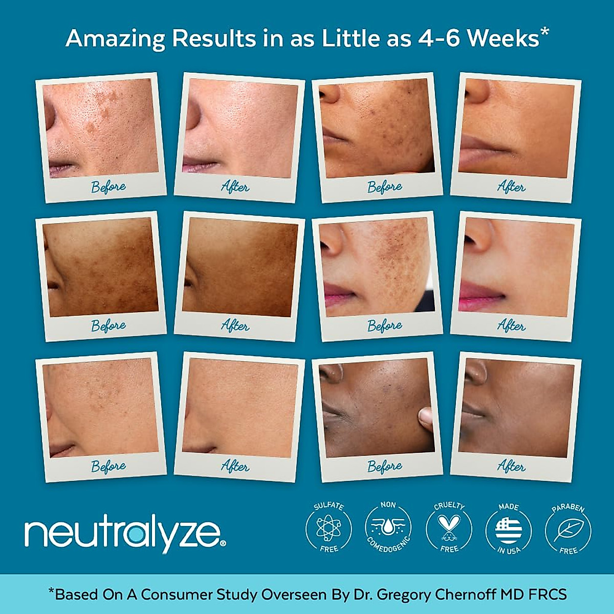 Brightening Dark Spot Corrector for Face - Maximum Strength Acne Dark Spot Remover, Brightening Serum & Fade Cream - Melasma Treatment for Face with Vitamin C, Niacinamide & Arbutin (90+ Day)