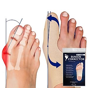 Bunion Corrector for Men & Women Big Toe Straightener for Inside Shoes Socks. Ultra Thin Hallux Valgus Socks to Separate & Straighten Great Toes. Day & Night Splints for Juanetes, X-Large-Left