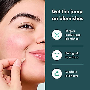 Mighty Patch Micropoint for Blemishes from Hero Cosmetics - Hydrocolloid Acne Spot Treatment Patch for Early Stage Zits and Hidden Pimples, 395 Micropoints (8 Patches)