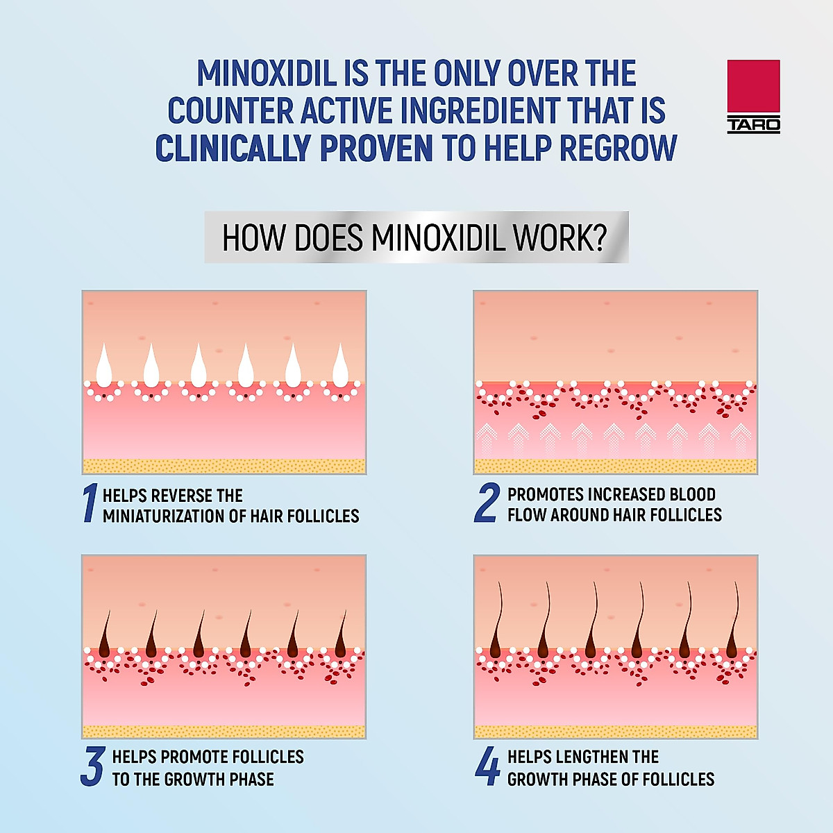 Taro Minoxidil Topical Aerosol Foam, 5%, Hair Regrowth Treatment for Men, 2.11 oz