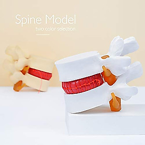 Anatomical Herniated Lumbar Vertebrae Disc Prolapse Model Human Medical Anatomy
