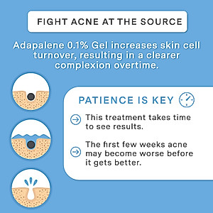 Curist Adapalene 0.1% Acne Free Gel (45gr 1.6oz 90 Day Supply - XL Tube) - Topical Retinoid Acne Medicine - Stop Acne Whiteheads Blackheads & Clogged Pores - Adapalene Retinoid Acne Treatment For Face