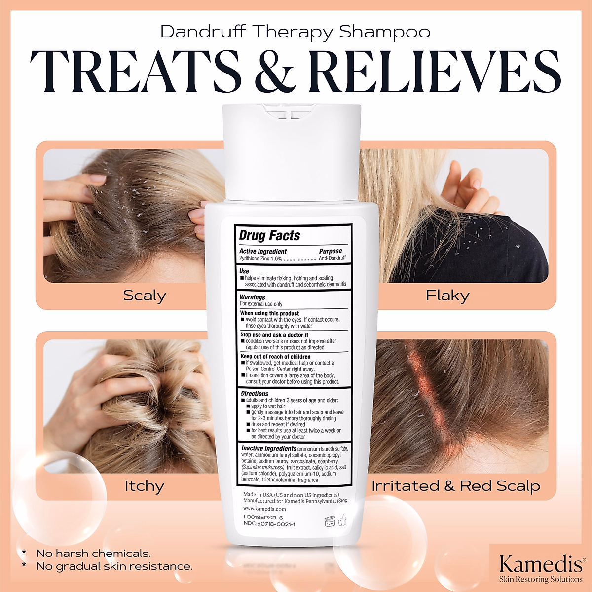 KAMEDIS Anti Dandruff Shampoo For Women & Men. For Itchy And Redness Scalp, Seborrheic Dermatitis Treatment & Flaky Hair. Contains 1% Zinc Pyrithione and Salicylic Acid. Paraben Free. 6.7 Fl Oz.