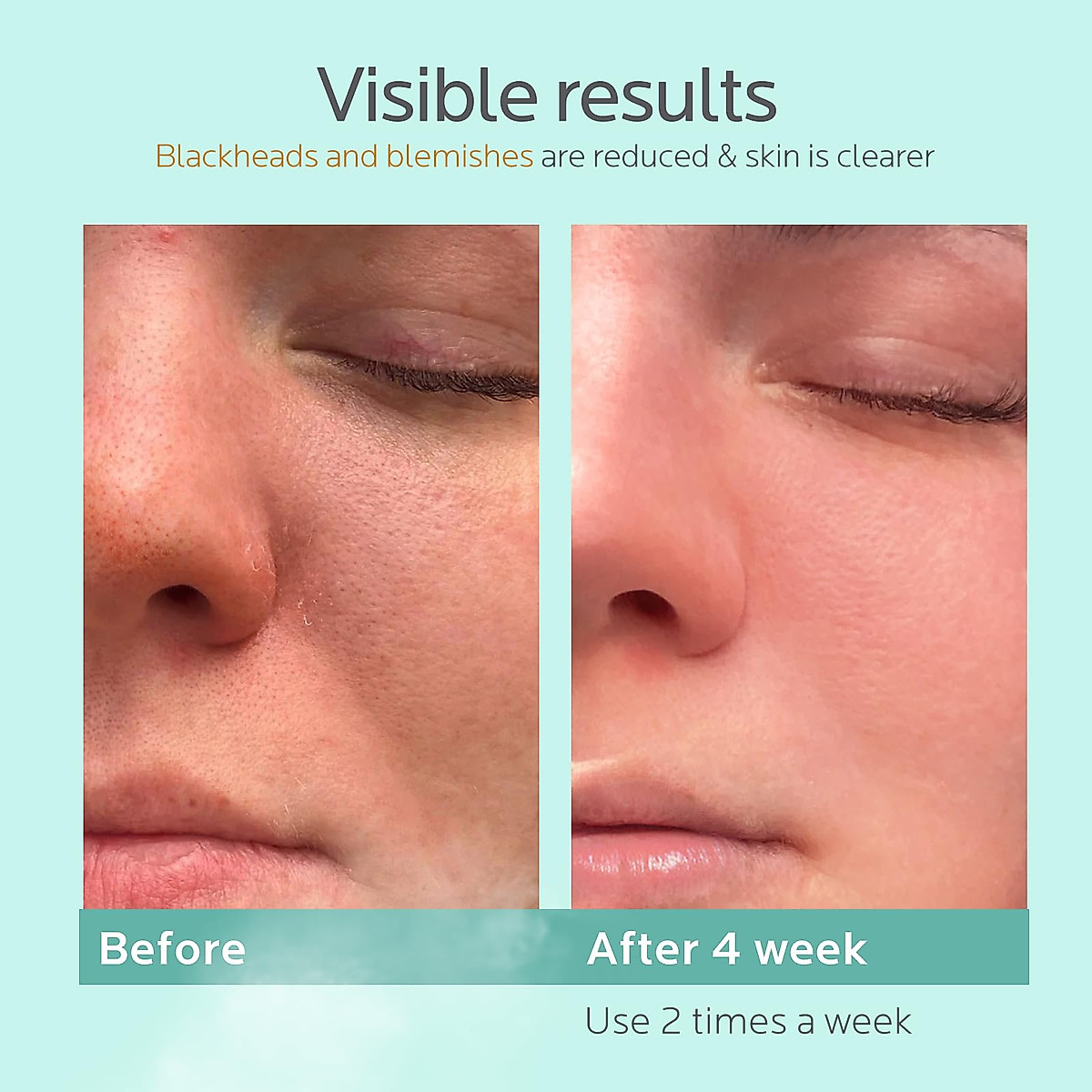 Colorfarm Facial Steamer Nano Ionic: Portable Face Steamer Deep Cleaning Unclogs Pores - Humidifier Hot Mist Steam Home Sauna Spa for Women Men Sinuses Moisturizing