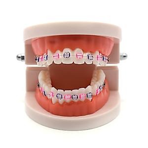 Angzhili 1 Piece Dental Demonstration Orthodontic Model with Metal Wires and Bracket (Ceramic bracket)