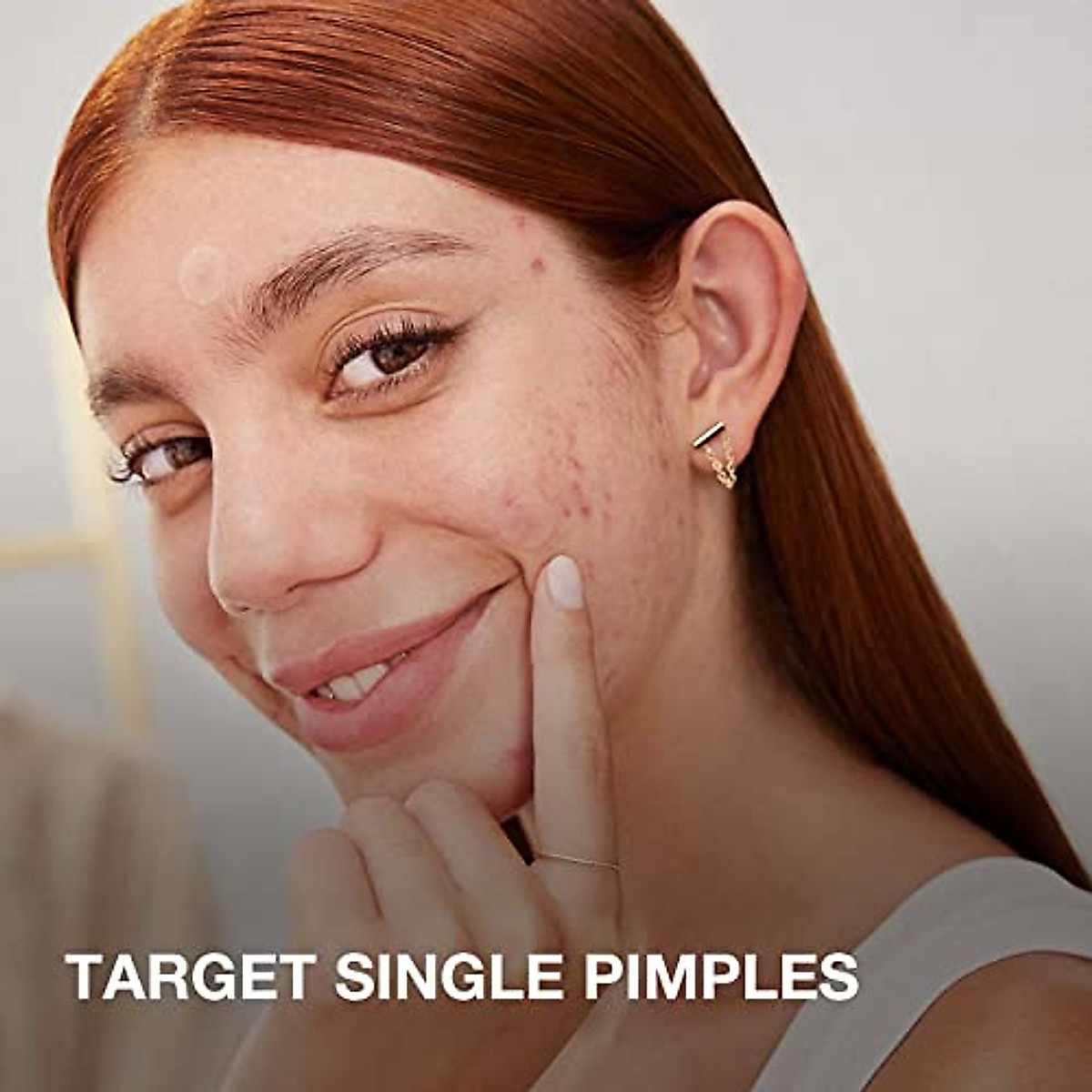 Neutrogena Stubborn Acne Pimple Patches, Acne Treatment for Face, Ultra-Thin Hydrocolloid Spot Stickers Provide Optimal Healing for Pimples, 24 Patches