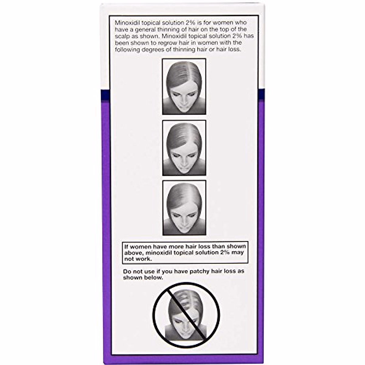 Equate - Hair Regrowth Treatment for Women with Minoxidil 2%, 3 Month Supply( 3 - 2oz bottles ) by Equate