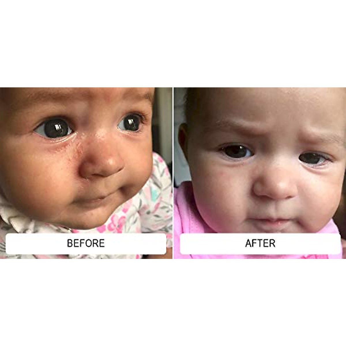 Happy Cappy Dr. Eddie’s Medicated Shampoo for Children, Treats Dandruff & Seborrheic Dermatitis, No Fragrance, Stops Flakes and Redness on Sensitive Scalps and Skin, Cradle Cap Brush Not Needed, 8 oz