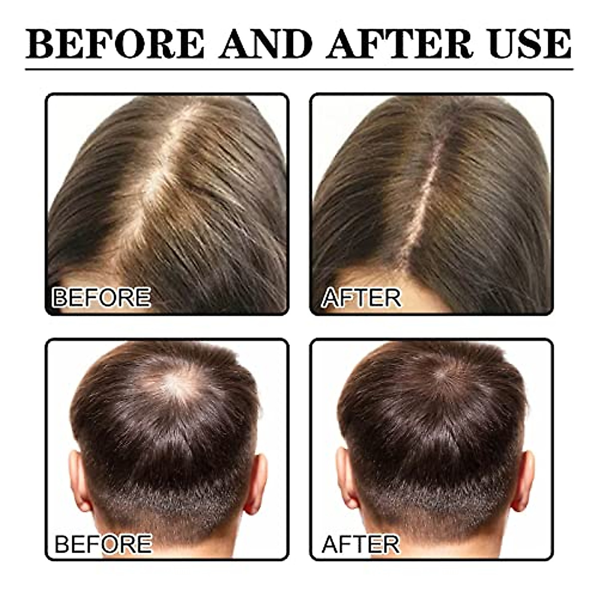 Allurium Hair Growth Serum for Black Women, Anti Hair Loss Nourish Dry Damaged Hair Repair, New Allurium Hair Growth Serum, Fast Natural Hair Growt, Allurium Beauty Hair Serum for Black Women (1PC)