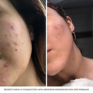 Bioelements Crucial Moisture - 2.5 fl oz - Emollient Cream Facial Moisturizer for Dry Skin - Improve Fine Lines - Vegan, Gluten Free - Never Tested on Animals, 2.5 Fl Oz (Pack of 1)