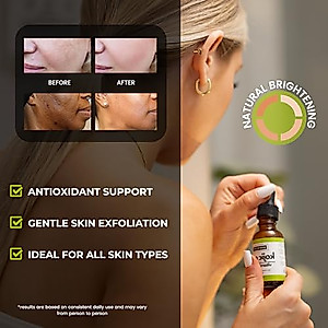 SkinSetGo Dynamic Antioxidant Dark Spot Remover Serum with Kojic Acid, Vitamin C, & Glycolic Acid, For Sun Spots, Age Spots, & Even Skin Tone