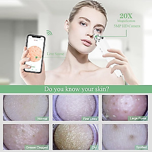 Blackhead Remover Pore Vacuum, 【[FDA Certification] 】WiFi Visible Facial Pore Cleanser with HD Camera Pimple Acne Comedone Extractor Kit with 6 Suction Heads Electric Blackhead Suction Tool