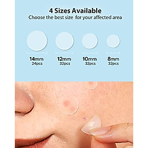 LitBear Acne Pimple Patches- Day and Night 4 Sizes 180 Dots Thin & Thick Hydrocolloid Patches with Witch Hazel, Tea Tree & Calendula Oil, Extra Adhesion Pimple Patches for Face Zit Patch Acne Dots