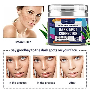 Inlifay Dark Spot Remover for Face Hyperpigmentation Treatment. Dark Spots, Melasma, Freckle, Sun Spots Removal Dark Spot Corrector Cream for Women and Men
