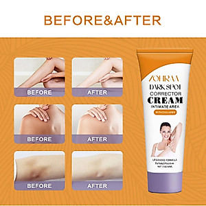 ZOHRAA Dark Spot Corrector Cream, Underarm Cream with Advanced Formula, Instant Results for Moisturizes Neck, Knees, Elbows, Armpit, and Private Parts - 2 fl. Oz