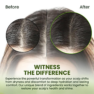 AtOne with Nature Itchy Scalp Treatment with Tea Tree Oil - Cleanses and Soothes, 2 Fl Oz, Infused with Sunflower, Argan, and Almond Oils