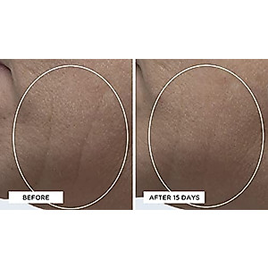 Perricone MD High Potency Classics: Hyaluronic Intensive Moisturizer 1 Fl Oz (Pack of 1)