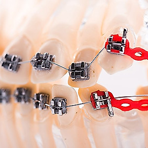 Easyinsmile Dental Orthodontic Treatment Model Teeth/Tooth/Denture Model with Braces for Dentist Studying Researching and Patient Education (Metal Bracket)