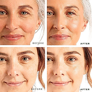 Tree of Life Beauty Facial Skin Care Set, Brightening, Firming, Hydrating, Dry Face, Dermatologist Tested - Retinol Serum and Hydrating Hyaluronic Acid - Skin Care Kit, 2 count of 1 Fl Oz