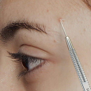 Suvorna Skinpal Pimple Popper Tool Kit | Milia Remover | Lancets for Facial Extraction | Whitehead Extractor Tool | Comedone Extractor | Blackhead Remover Tool | Acne Needle Tool & Cyst Removal Tool.