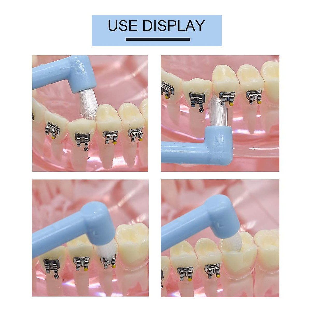 Angzhili 9 Pieces Interspace Toothbrush,End Tuft Orthodontic Toothbrush Tapered Orthodontic Brush for Hard to Reach Areas,Gap Toothbrush for Orthodontic Braces Bridges and Implants