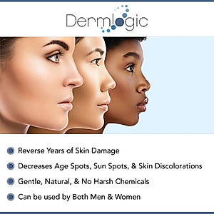 Dark Spot Corrector Cream- Visibly Fades & Repairs Marks from Dark Spots, Sunspots, Age Spots, Acne Scars, Brown Spots & Freckles for Face & Body. Safe for All Skin Types. 