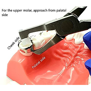 Molar Band Remover pliers band removing pliers Orthodontic Braces Removal Tool Dental ARTMAN brand by Wise Linkers