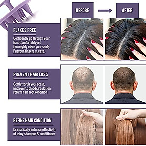 WAKISAKI (2-Pack) Hair Scalp Massager for Hair Growth, Mold-Free Silicone Scalp Massager Shampoo Brush, Scalp Scrubber Exfoliator for Dandruff Itchy Flaky Scalp, Works for Wet and Dry Hair, (Purple)