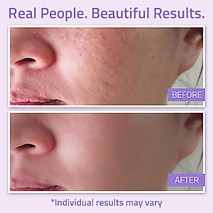 YEOUTH Hydrating Toner for Face Spray with Chamomile and Allantoin, Alcohol Free Refreshing Face Toner for Women and Men 3.4 Oz