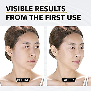 DOCTORCOS Silicone Skin Mask | Face Lifting Double Chin Reducer | V Line Lifting | Under Eye Mask | Forehead Wrinkles Treatment | Korean Skin Care