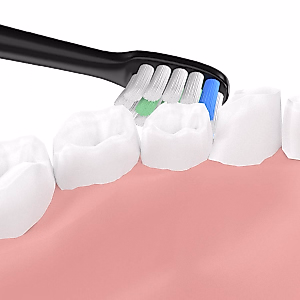 WuYan 4 Pack Toothbrush Heads for Xiaomi Deep Cleaning, Automatic Electric Sonic Replacement Tooth Brush for Soocare X3 Electric toothbrushes, with Travel Caps