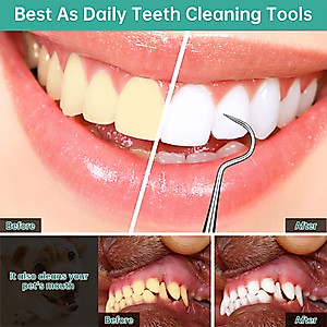 Professional Dental Scraper Tool - Dentist Pick, Medical Stainless Steel, Dental Tarter Scraper for Tooth Stains Remover, Dentist Home Use Tools