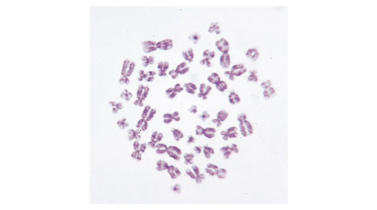 Human Female Chromosomes Slide - 46, XX for Genetics Study