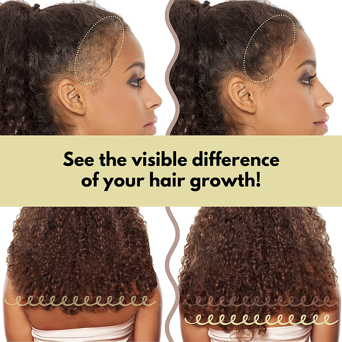 mimosu Rice Water for Hair Growth & Repair: DIY Tea Bags, Natural Conditioner, Detangler & Hair Nourisher with Fermented Rice Protein for Curly, Damaged Hair