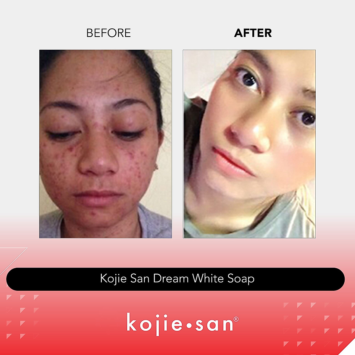 Kojie San Dream White Soap - Skin, Body, and Facial Brightening & Anti Aging Kojic Acid Soap with Collagen, Elastin & Coconut Oil - 65g x 2 Bars