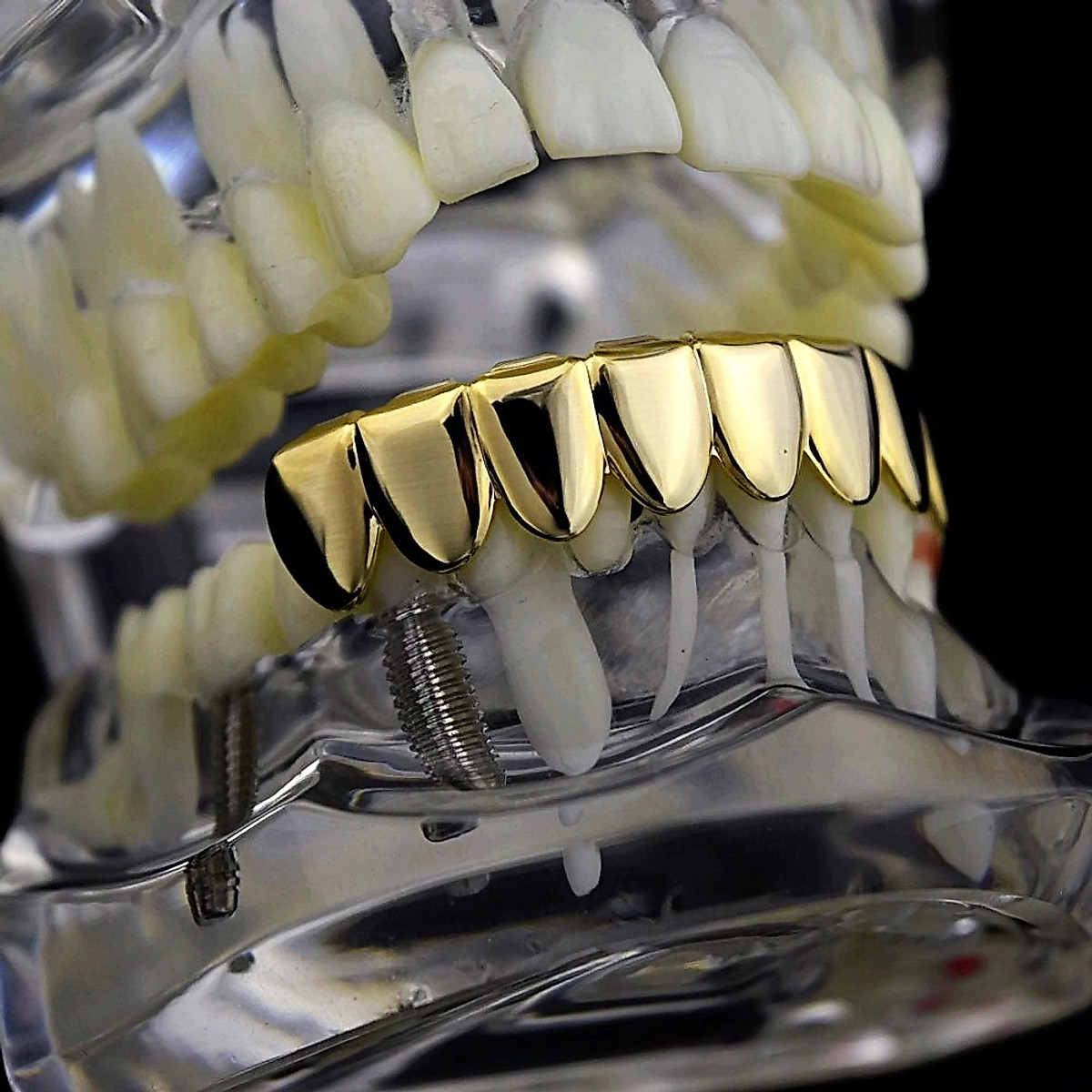 Bottom Eight Tooth Grillz 14k Gold Plated Lower Row Slugs Plain 8 Teeth Hip Hop Grills
