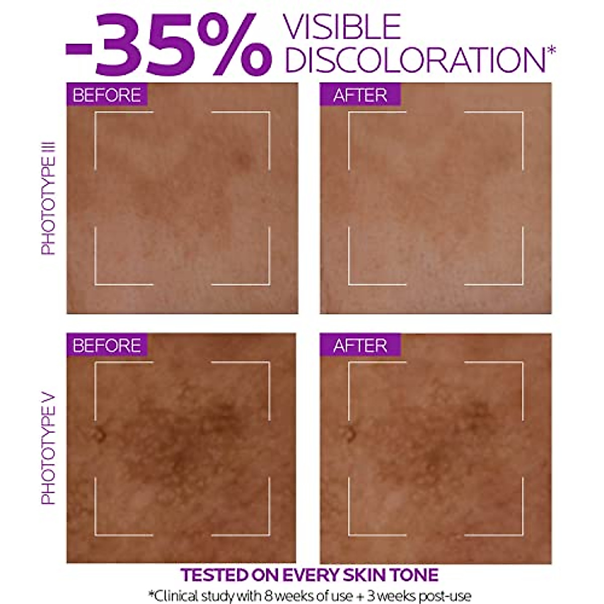 La Roche Posay Niacinamide 10 Face Serum, Brightening and Anti-Aging Facial Serum with 10% Niacinamide, Reduces the Look of Dark Spots, Discoloration, and Uneven Skin Tone