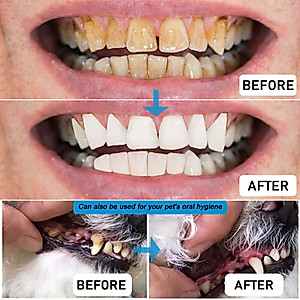 3Pcs Dental Tools, 100% Surgical 304 Stainless Steel Dental Pick, Professional Teeth Cleaning Kit for Home Use, Tartar Plaque Remover for Teeth Dentist Tools, Dental Scaler- with Traveling Case