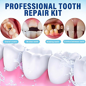 Tooth Replacement Kit, Replace a Missing Tooth in Minutes, Veneers for Temporary Tooth Repair, Complete Your Smile with Temporary Tooth, Nature and Comfortable Veneers