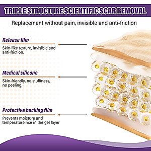 Silicone Scar Sheets,Silicone Scar Tape,Scar Tape For Surgical Scars,Silicone Scar Removal Strips For Surgical,C-Section,Tummy Tuck,Keloid Scars(1.6"X 59" Roll-1.5M) Keloid Bump Removal