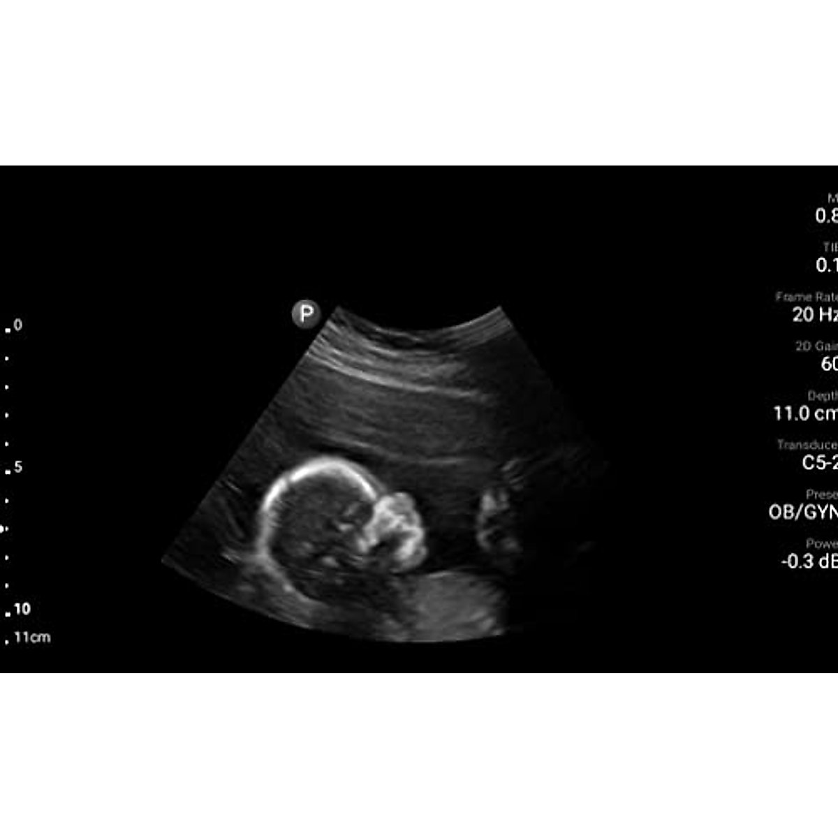 Philips Lumify C5-2 Curved Array Transducer, Portable Ultrasound Solution