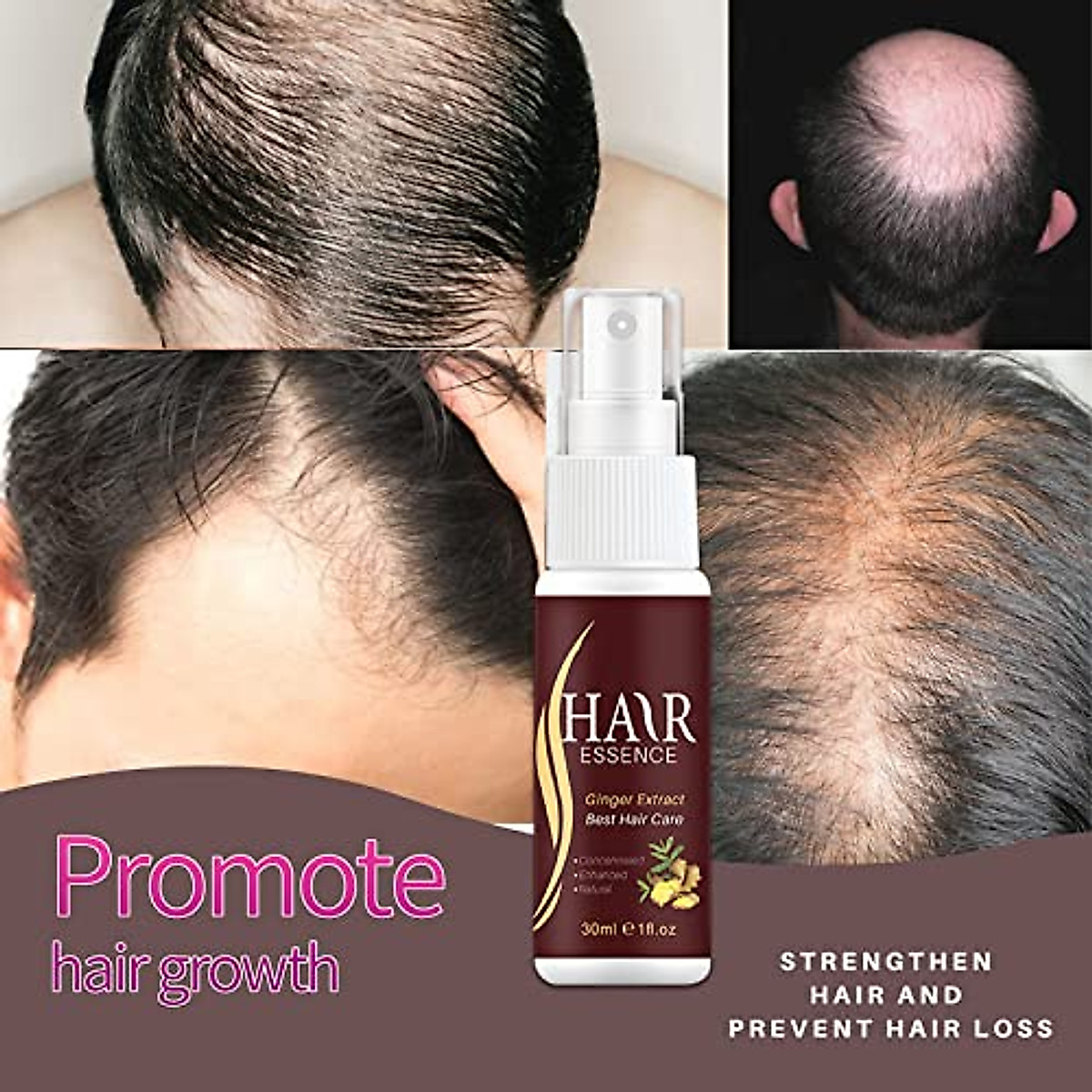 Korean Face Roller Hair Spray Hair Growth Oil Hair Growth Thicker Fuller Healthier Hair Hair Loss And Thinning Women And Men 30ml for Skin Care