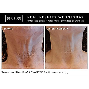 Revision Skincare Nectifirm Advanced Neck Firming Cream, 1.7 oz