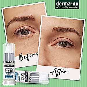 Eye Gel Anti-Aging Cream - Treatment for Dark Circles, Puffiness, Wrinkles and Fine Lines - Hyaluronic Acid Formula Infused Serum with Aloe Vera & Jojoba for Ageless Smooth Skin 5 oz