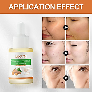 Turmeric Dark Spot Corrector Serum Turmeric and Vitamin C Serum for Face Dark Spot Correcting Glow Serum Dark Spot Remover for Face Tumeric Serum Acne Dark Spots Hyperpigmentation Smooth Skin 1oz